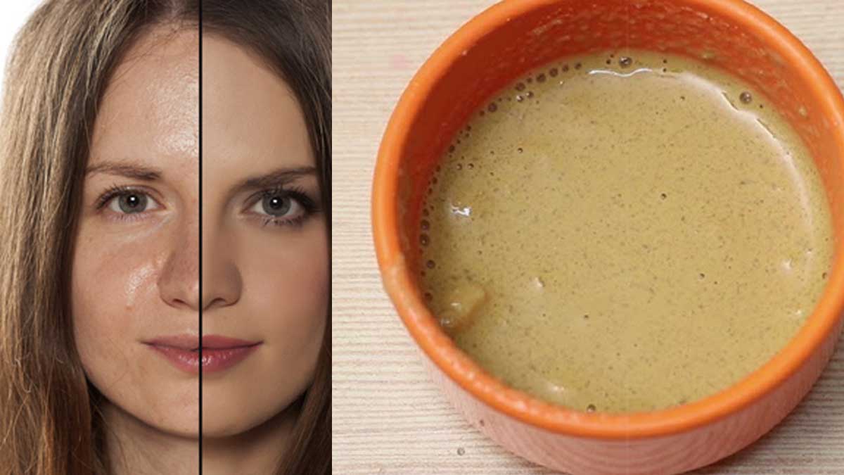 Oily Skin : ఇలా చేస్తే.. ముఖంపైకి ఎప్పుడూ జిడ్డు చేర‌దు.. కాంతివంతంగా క‌నిపిస్తుంది ...