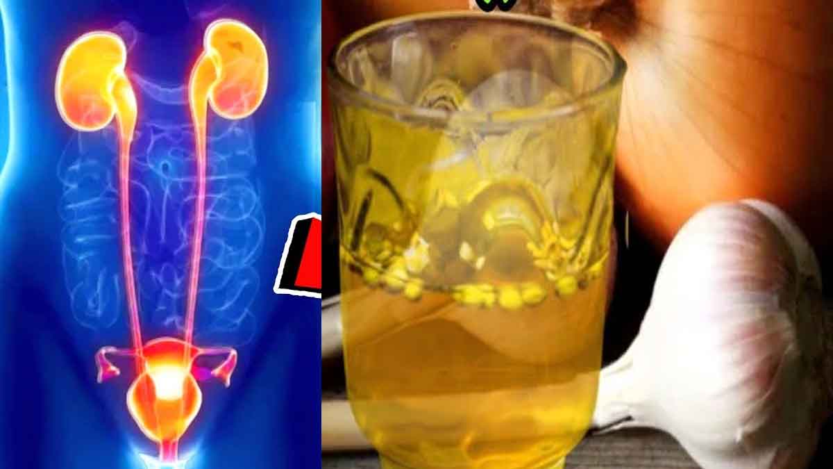Urine Infection కేవలం 5 నిమిషాల్లో మూత్రంలో మంట యూరిన్ ఇన్ఫెక్షన్ సమస్యల‌ను తగ్గించే